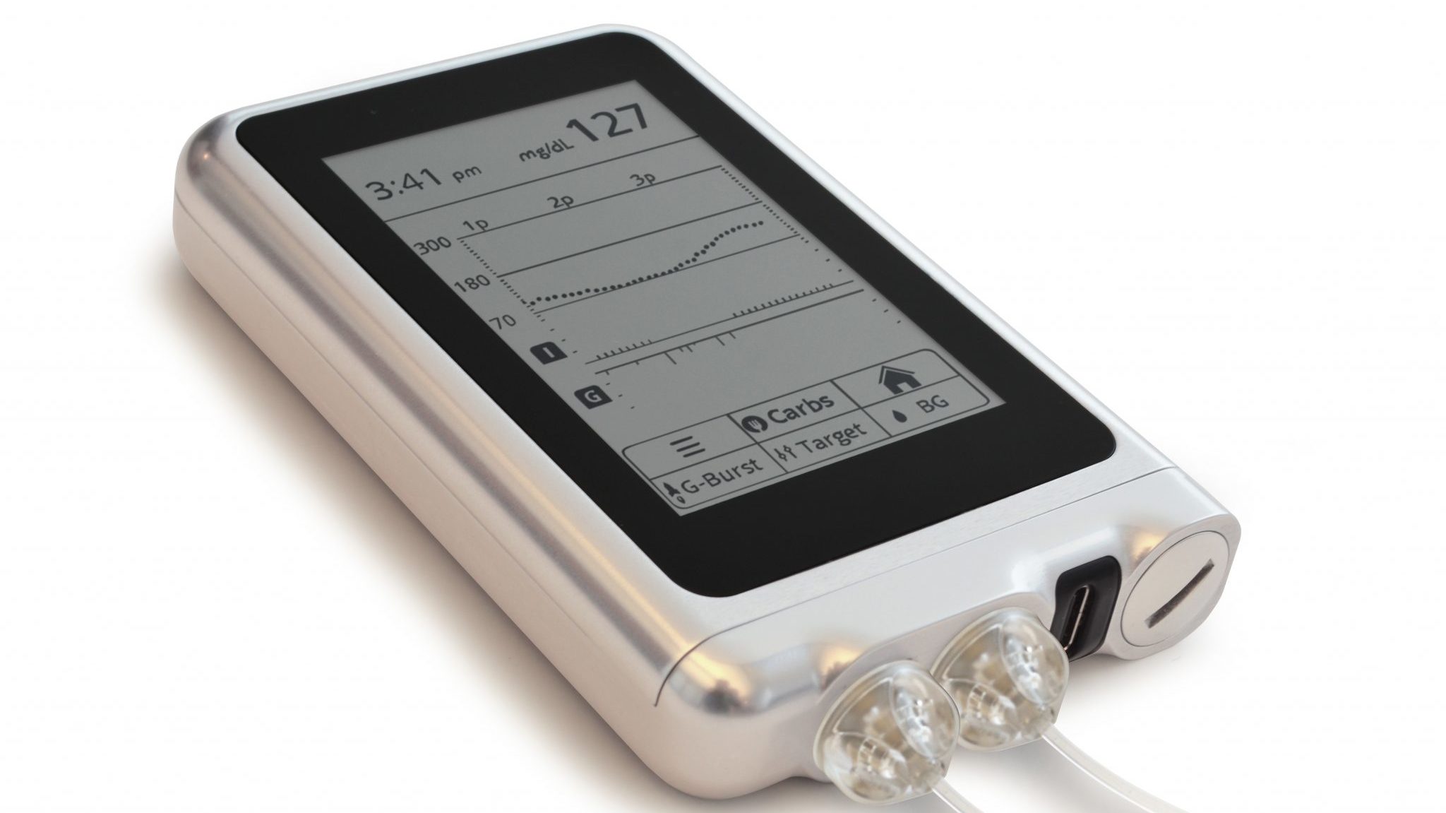 Breakthrough in Treatment for Type 1 Diabetes with Artificial ...