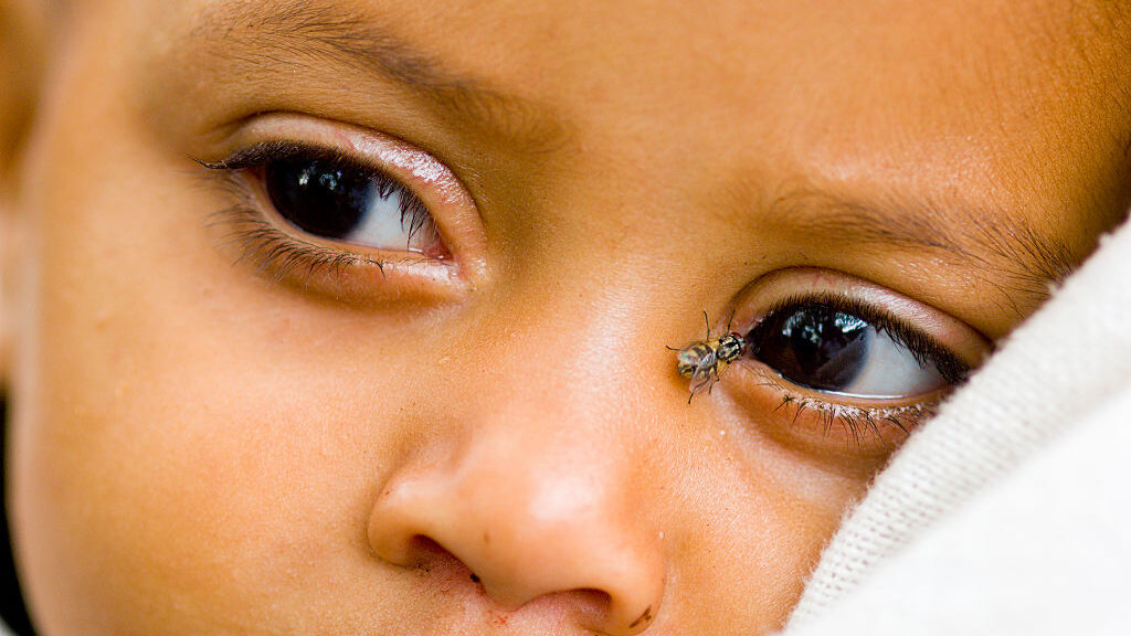 One More Country Beats Disease that Turns People Blind | twib.news