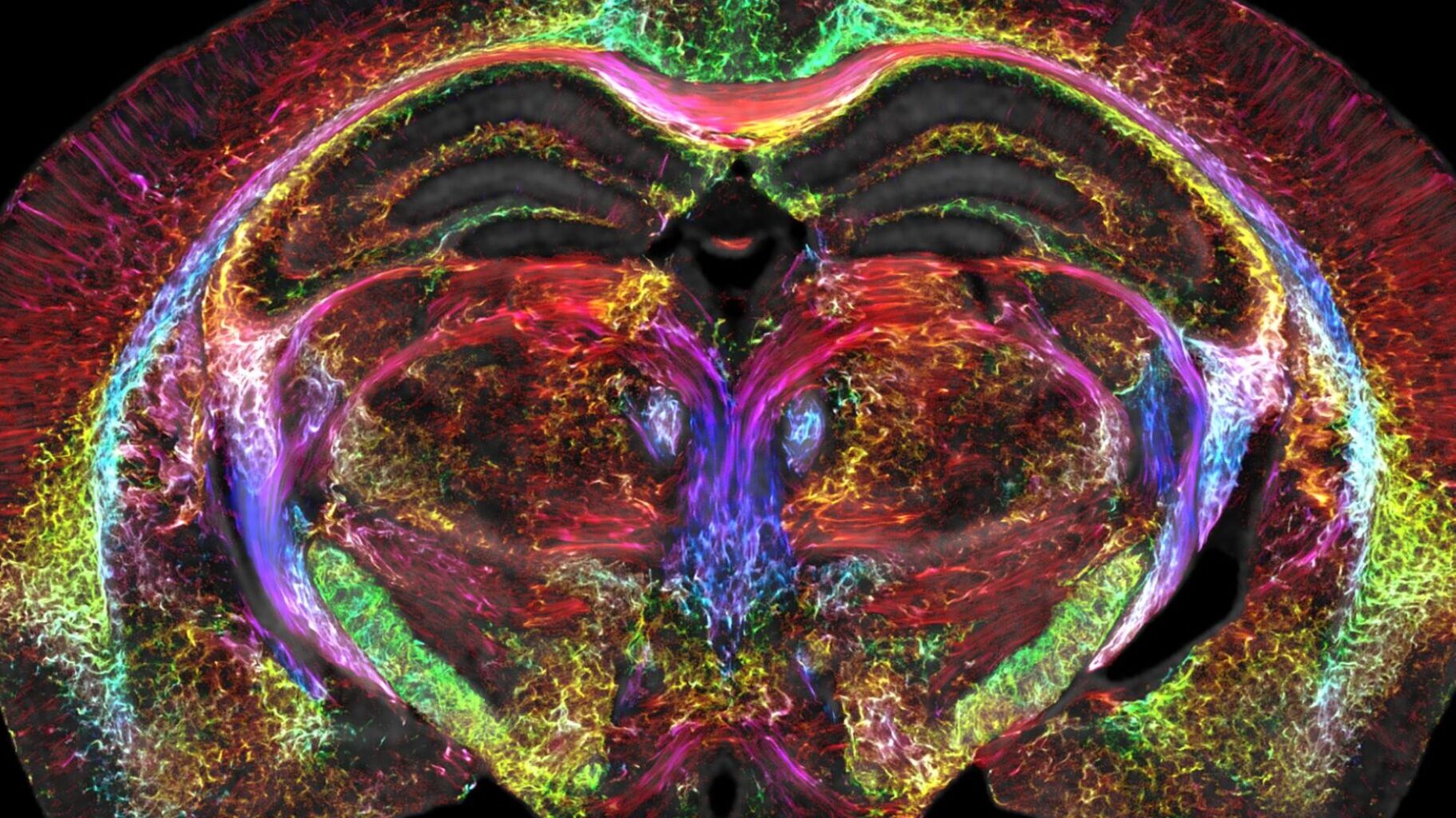 Sharper MRIs: Brain Scans Are Looking Clearer Than Ever | twib.news